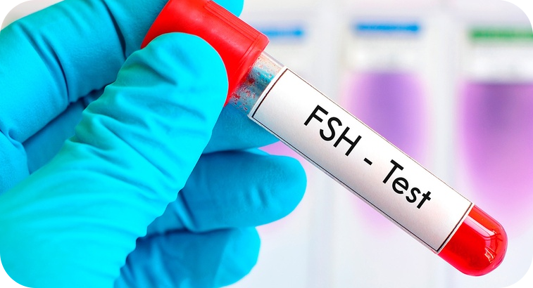 FSH (Hormona Folículo Estimulante) - Laboratorio GineLab